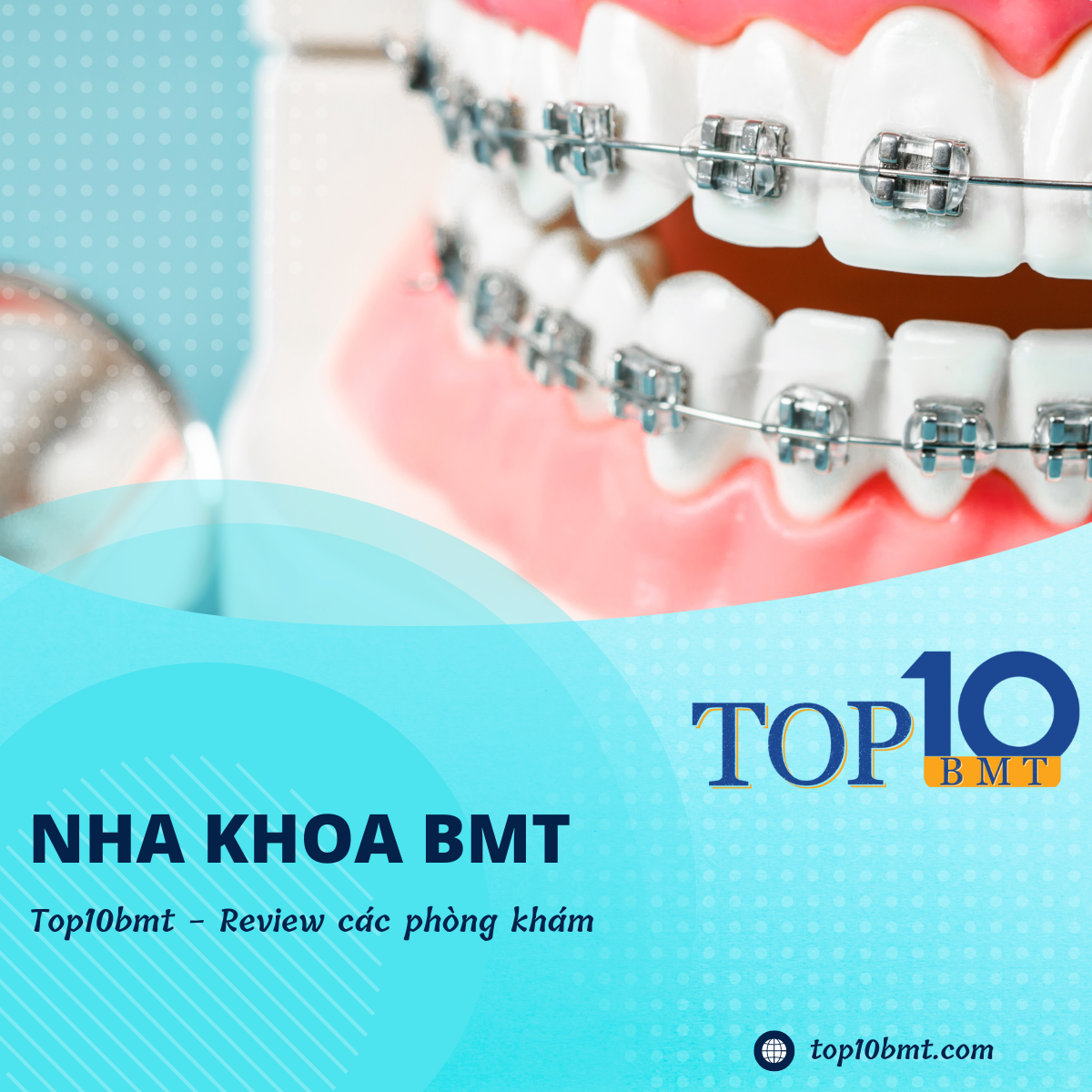 Top 10 phòng khám nha khoa BMT có dịch vụ tốt nhất hiện nay